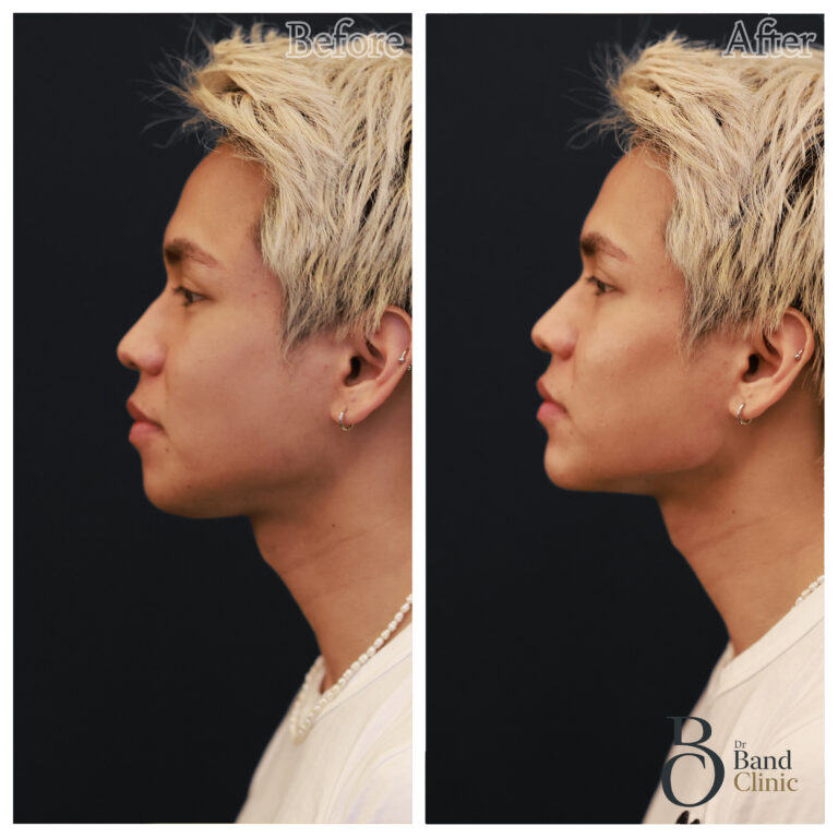 Charming Chin - The Skin Bros